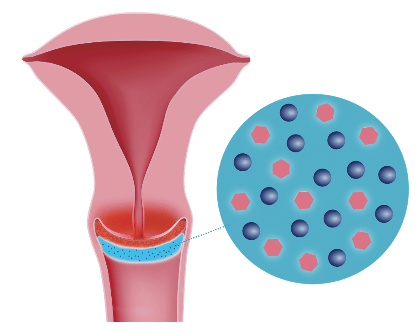 Get active - DeflaGyn®