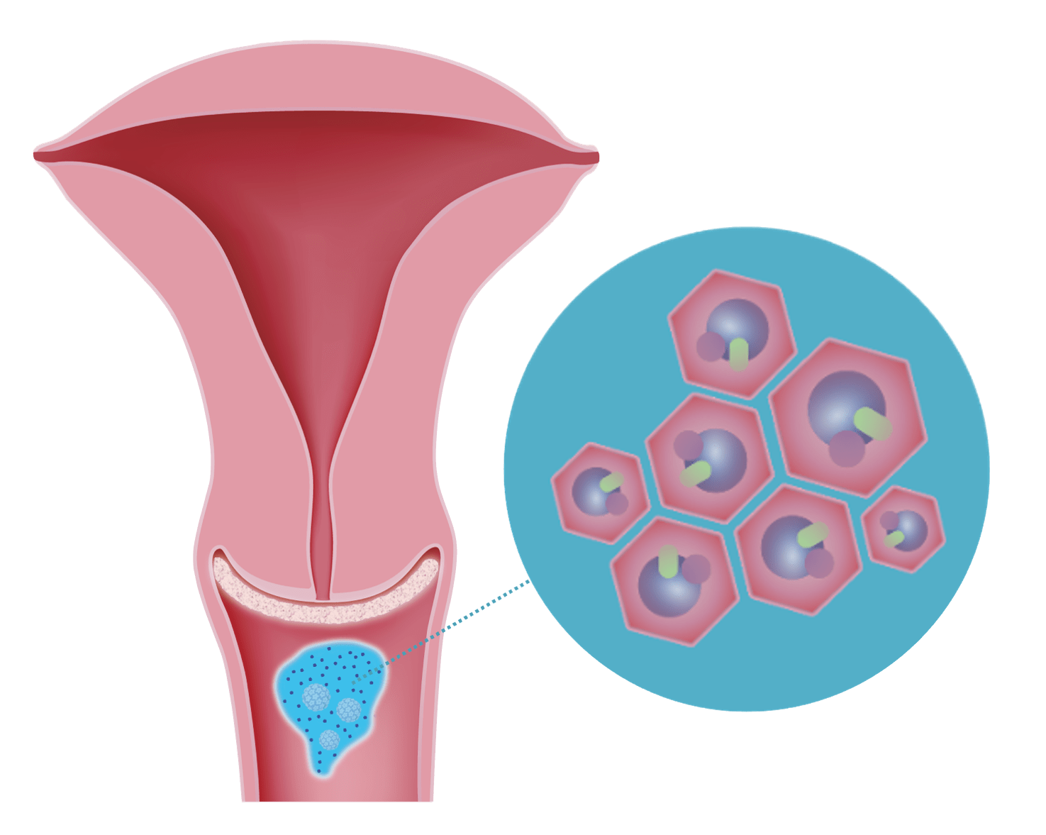 Get active - DeflaGyn®