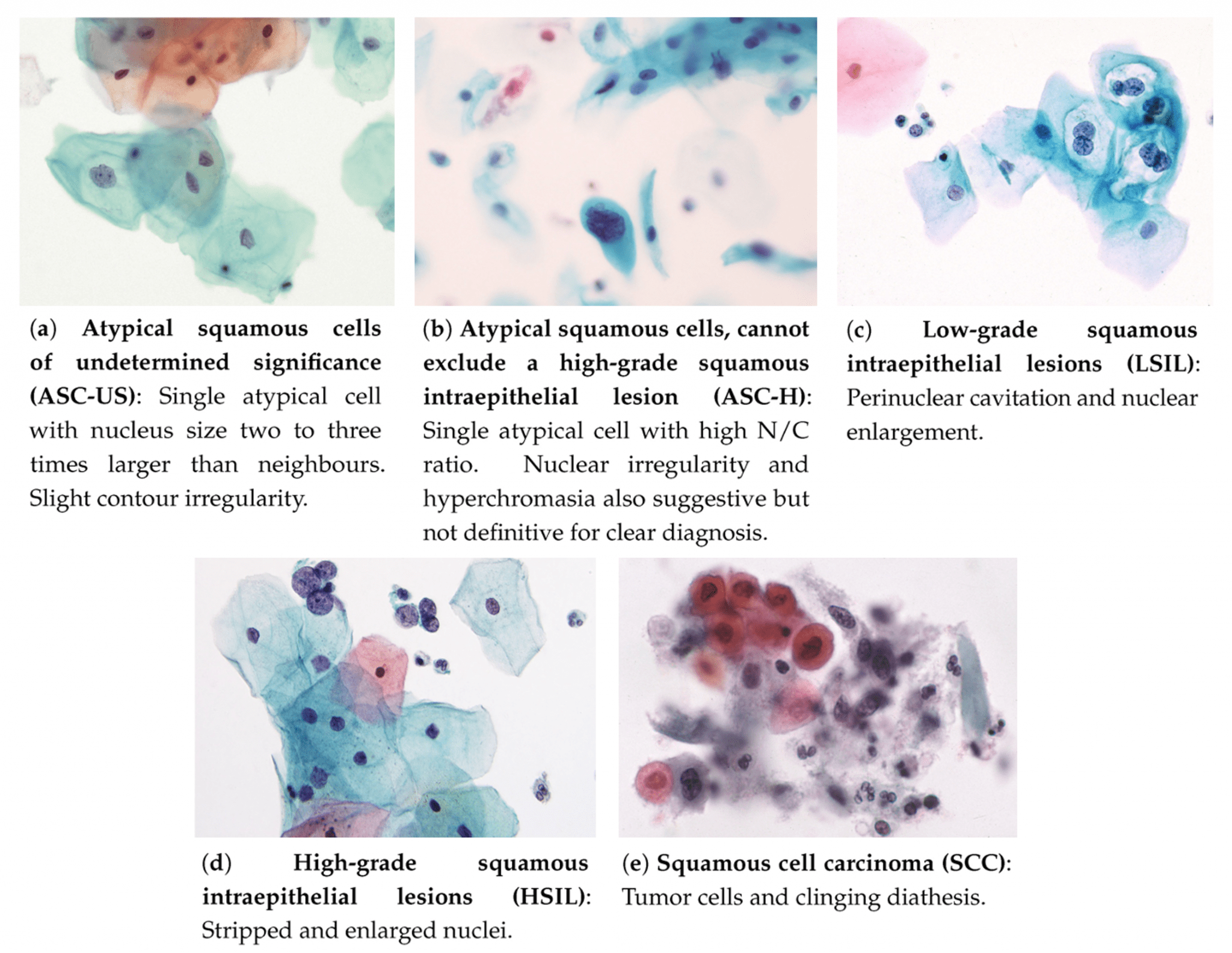 Screening - DeflaGyn®
